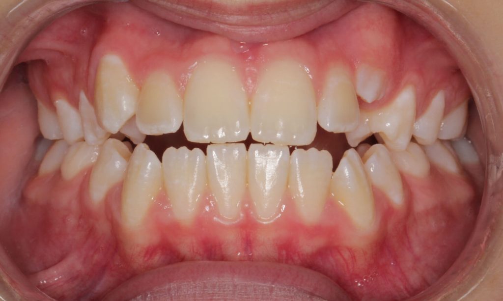 Doyle OrthodonticsDoyle Orthodontics